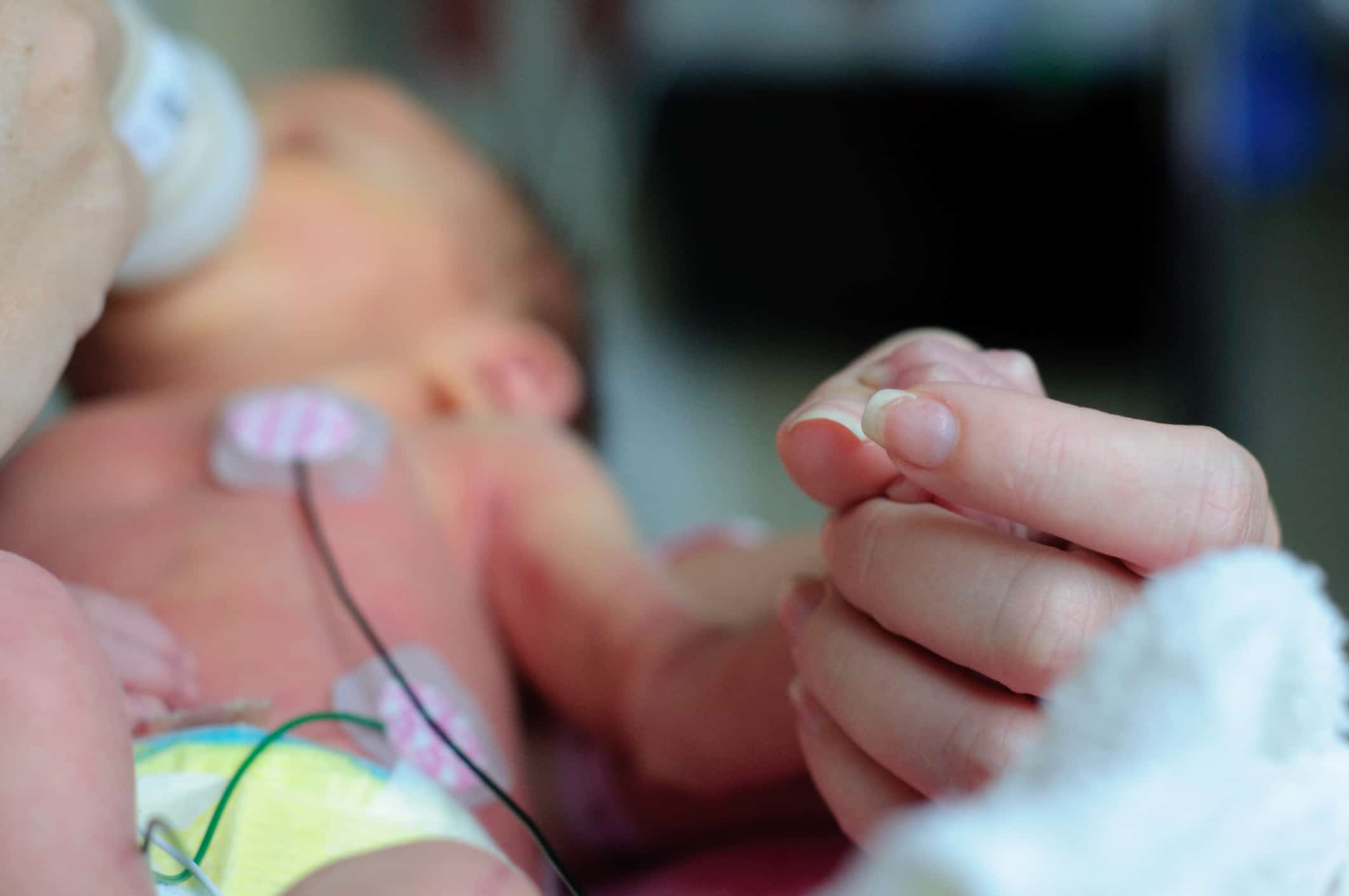 United States Maternal Mortality Rates Alarmingly High, Studies Show | ABD United States Maternal Mortality Rates Alarmingly High, Studies Show | ABD